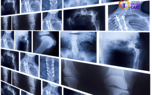 What Can X Rays Detect? - Centers Urgent Care