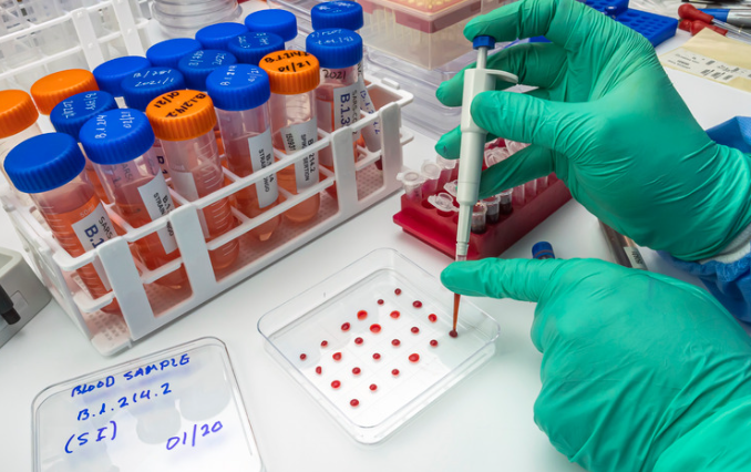 Antibody Test Blood: What You Need to Know - Centers Urgent Care