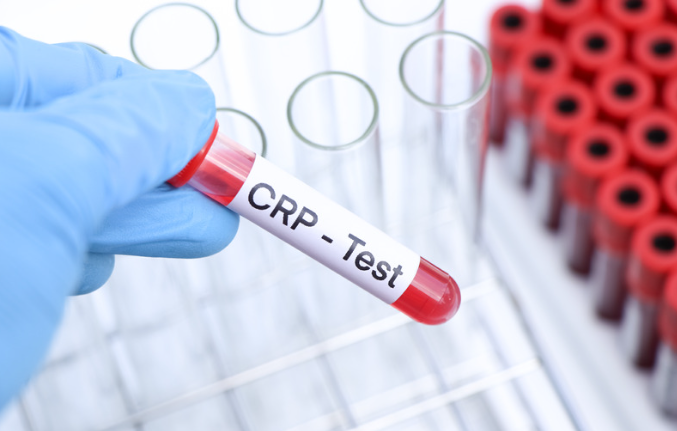 CRP Blood Test: What Does It Mean? - Centers Urgent Care