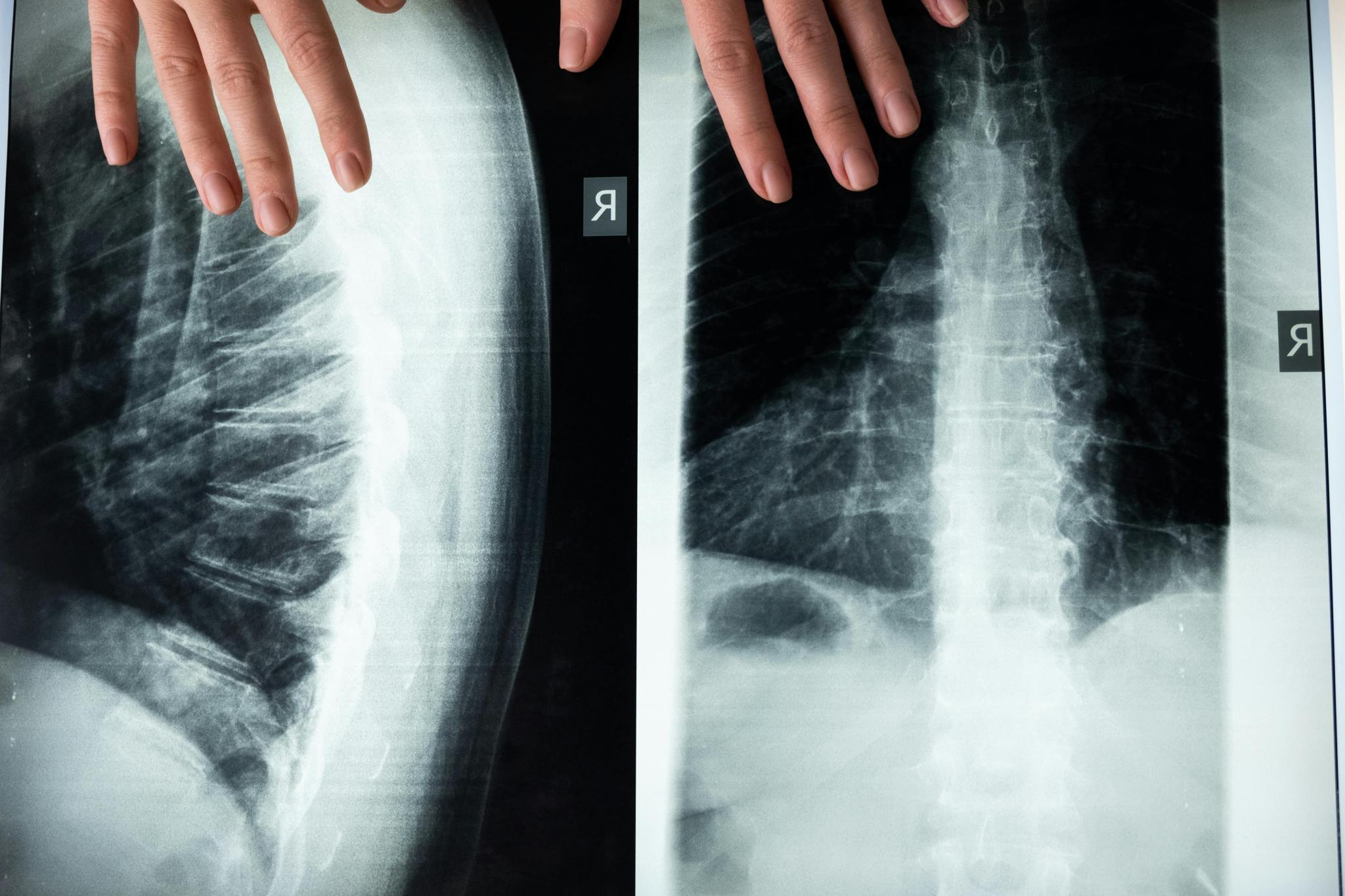 How Many X-Rays Can You Have in a Year? - Centers Urgent Care