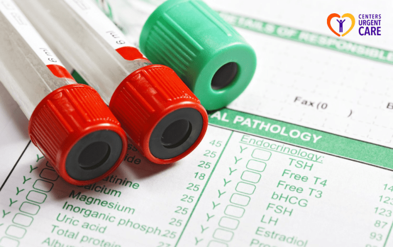 Are False Negatives in STD Testing a Common Issue? - Centers Urgent Care