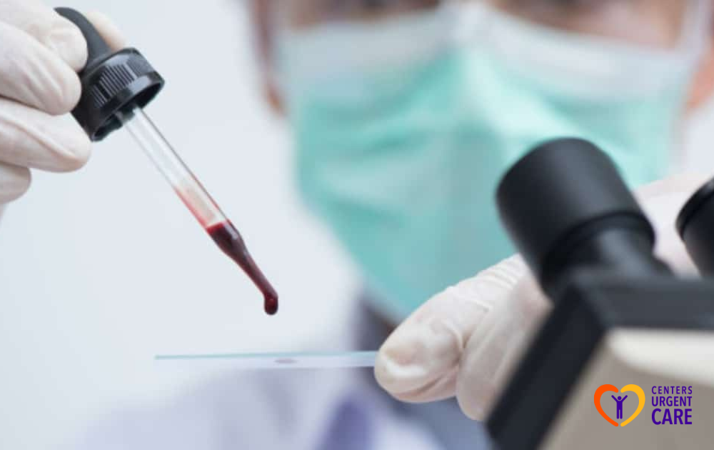 Step-by-Step Guide to Blood Smearing - Centers Urgent Care
