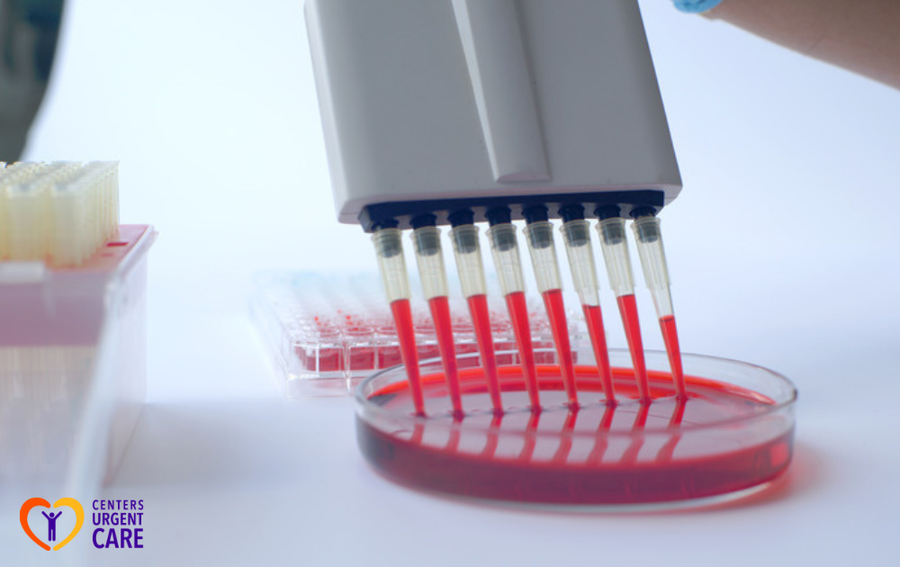 Hemoglobin Blood Test: What You Should Know - Centers Urgent Care