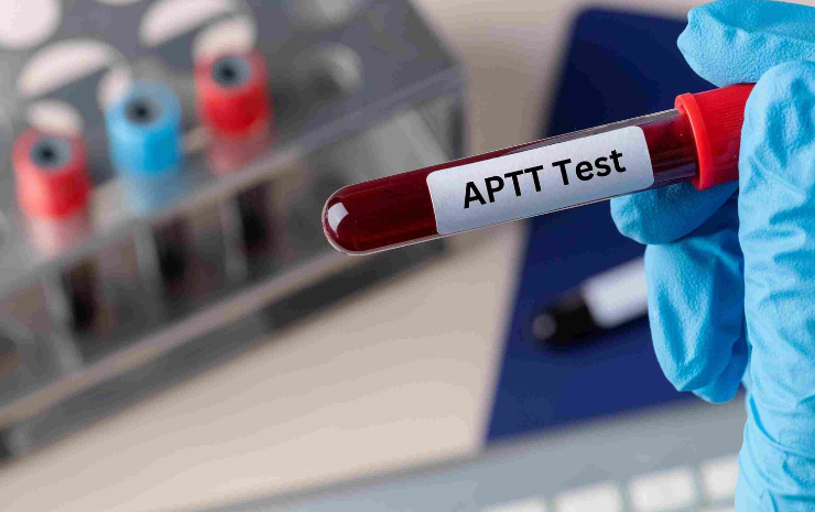 The Significance of the APTT Blood Test - Centers Urgent Care