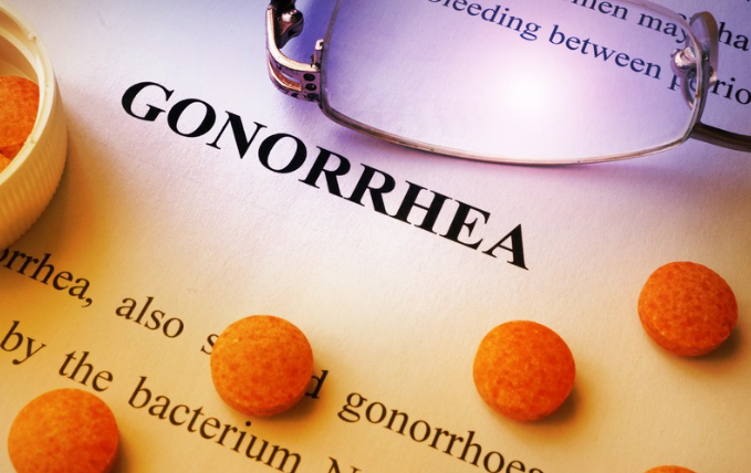 Recognizing the Signs of Gonorrhea - Centers Urgent Care