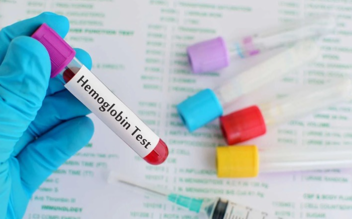 Hemoglobin Blood Test: What You Should Know - Centers Urgent Care