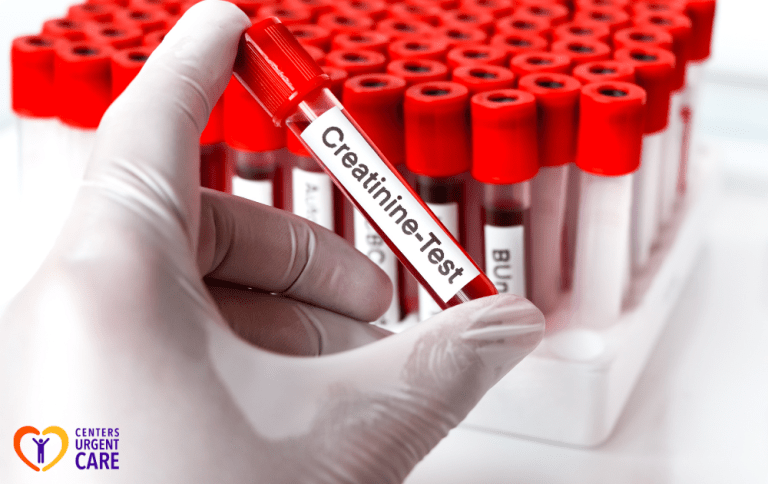 Understanding Blood Test Results in Kidney Disease - Centers Urgent Care