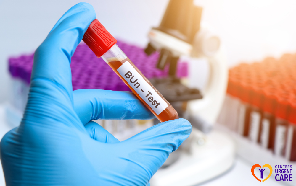 Understanding Blood Test Results in Kidney Disease - Centers Urgent Care
