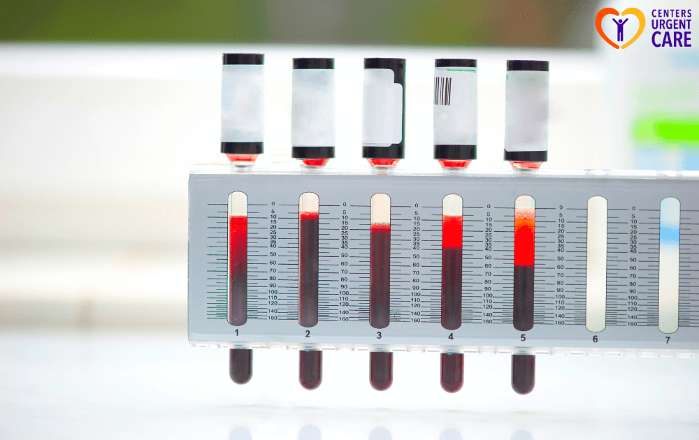What You Should Know About ESR Blood Test - Centers Urgent Care