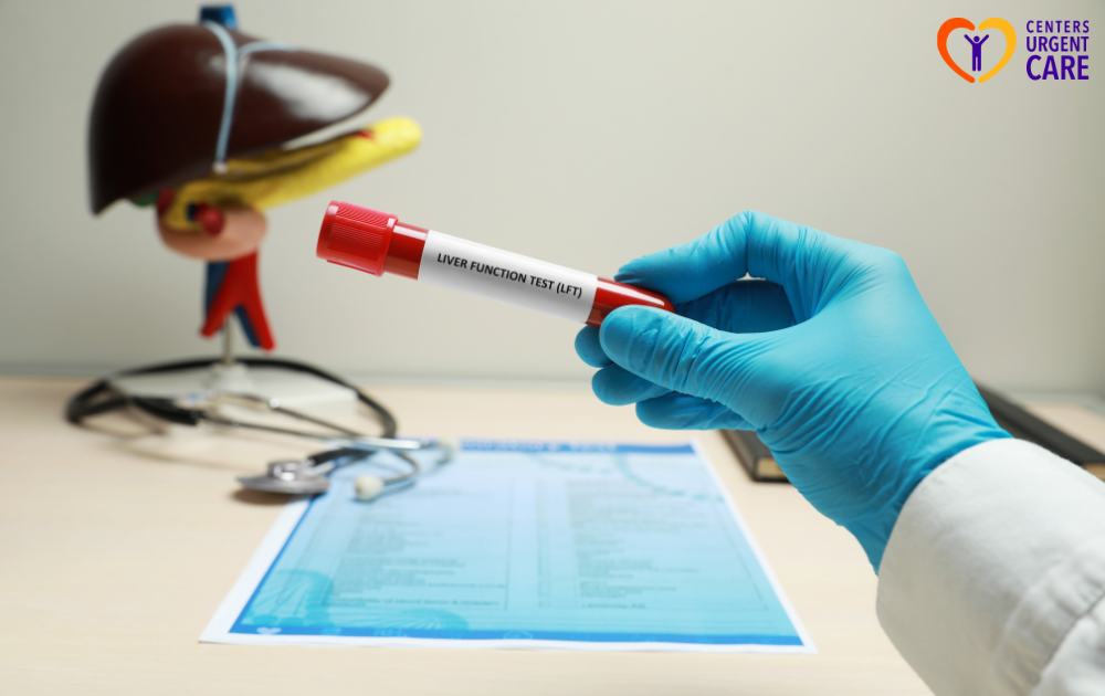 MCV in a Blood Test: Significance Explained - Centers Urgent Care