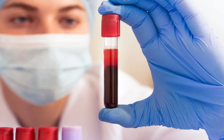 MCV in a Blood Test: Significance Explained - Centers Urgent Care