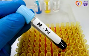 What is a Blood Test INR and Why It’s Done - Centers Urgent Care