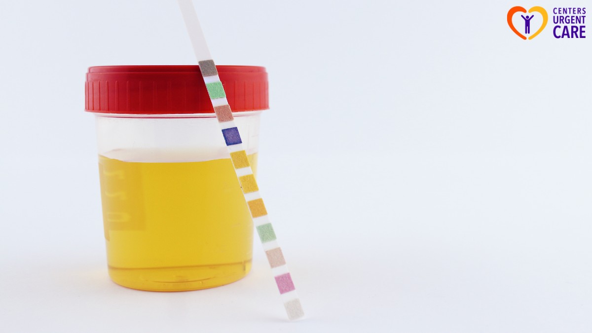Urine Color Chart: What Your Pee Says About Your Health - Centers ...