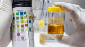 Urine Color Chart: What Your Pee Says About Your Health - Centers ...