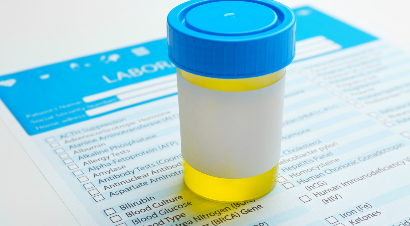 24-Hour Urine Collection: What Does It Reveal? - Centers Urgent Care