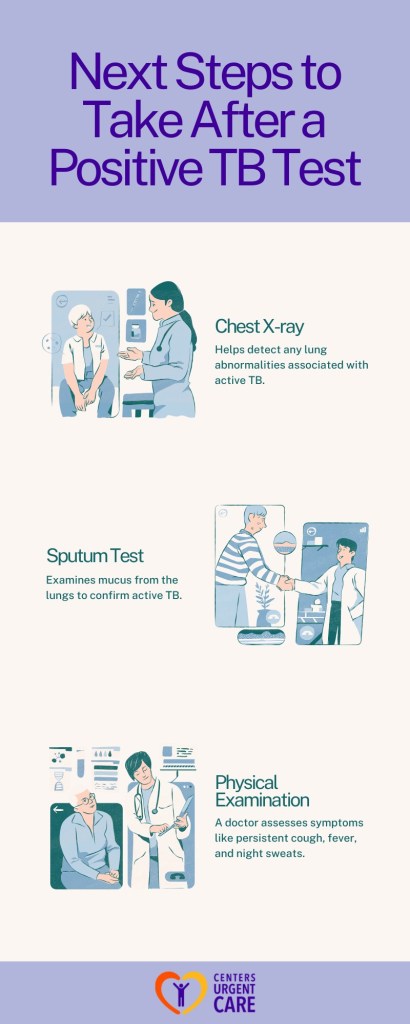 What Happens if Your Tuberculosis Test is Positive? - Centers Urgent Care