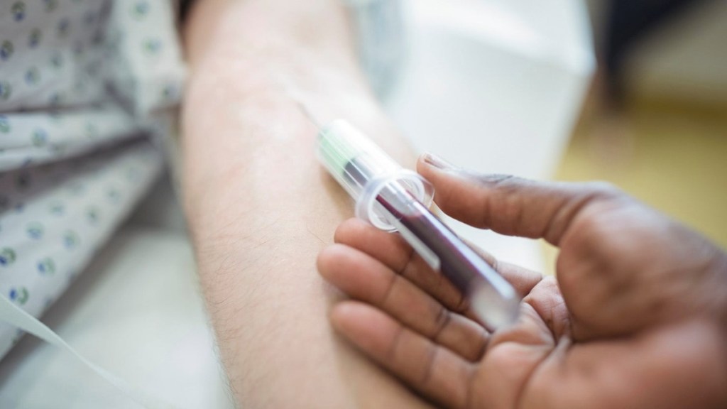 PPD Tests: Myths vs. Facts - Centers Urgent Care