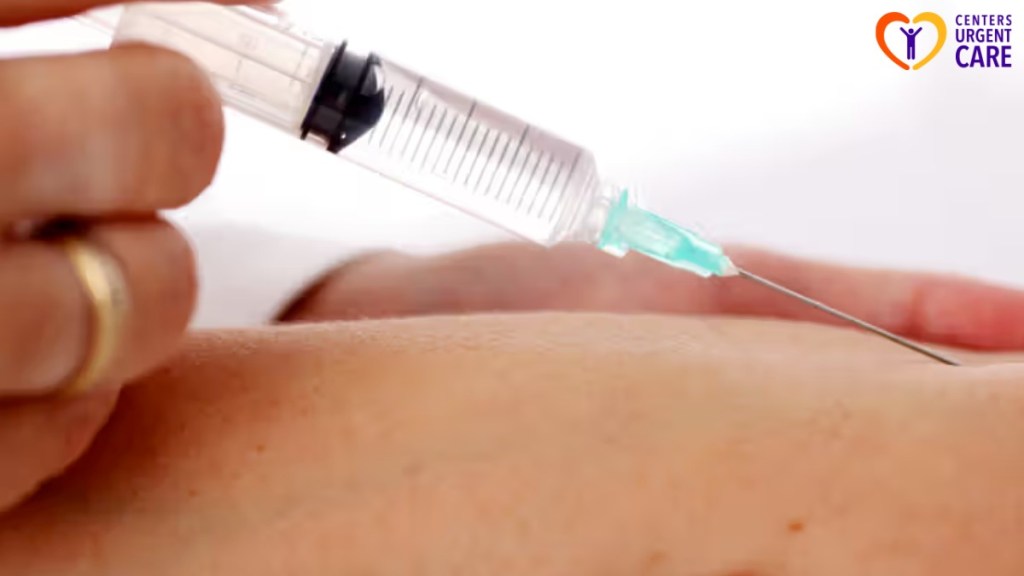 PPD Tests: Myths vs. Facts - Centers Urgent Care