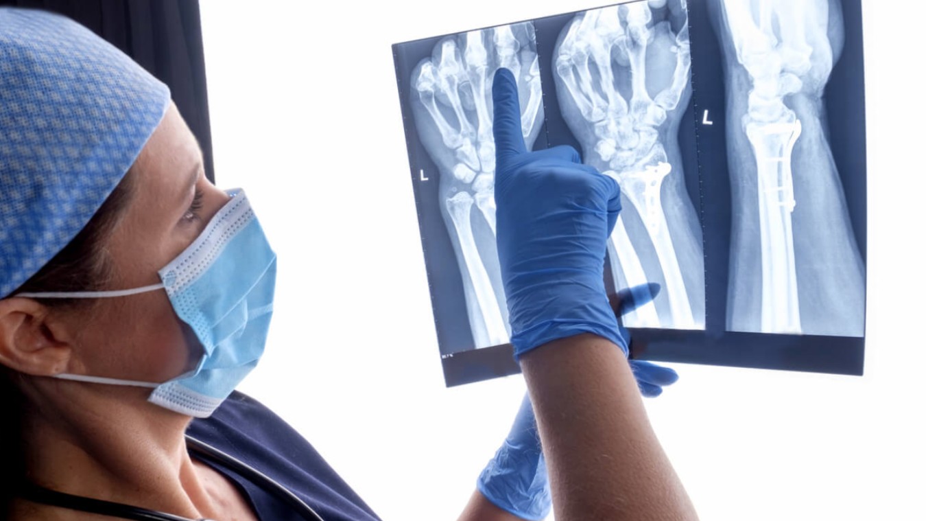 Can X-Rays Detect Soft Tissue Damage? - Centers Urgent Care