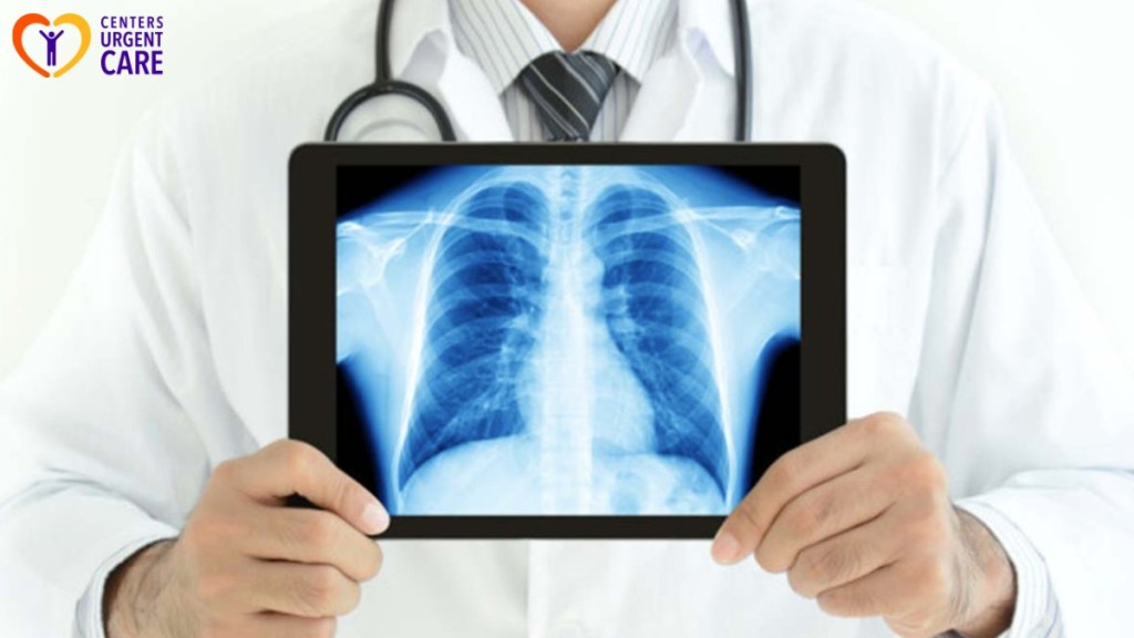 Understanding the Limitations of X-Ray Imaging - Centers Urgent Care