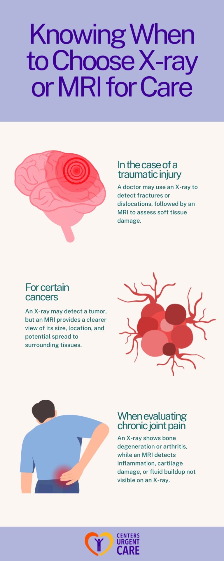 X-ray vs MRI: Understanding the Key Differences - Centers Urgent Care