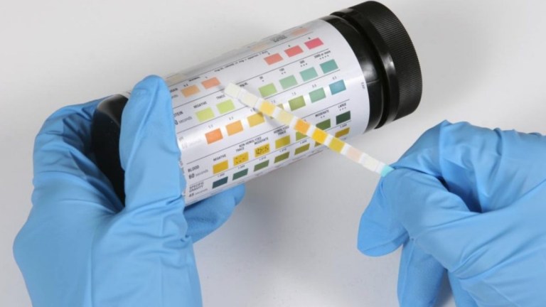 Dipstick Test Urinalysis and What It Can Reveal - Centers Urgent Care