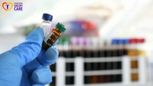 GC Drug Testing and What It Means for Your Health - Centers Urgent Care