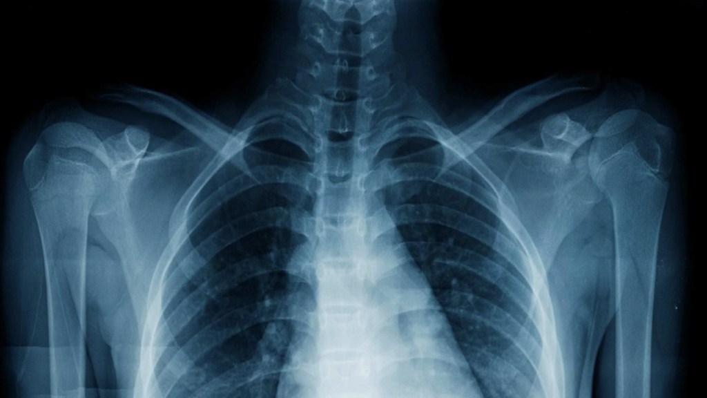 X-ray vs MRI: Understanding the Key Differences - Centers Urgent Care