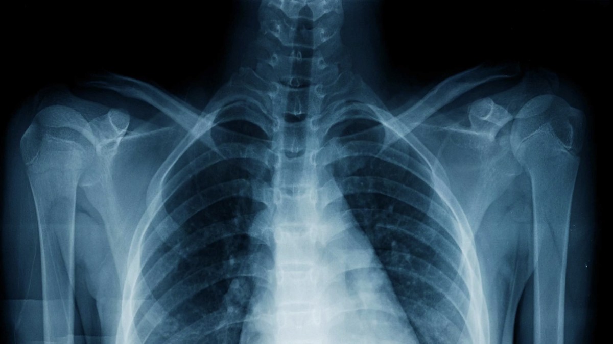 X-ray vs MRI: Understanding the Key Differences - Centers Urgent Care