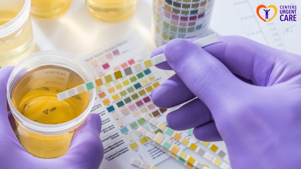 How to Read Microalbumin Urine Results to Understand Your Kidney Health ...