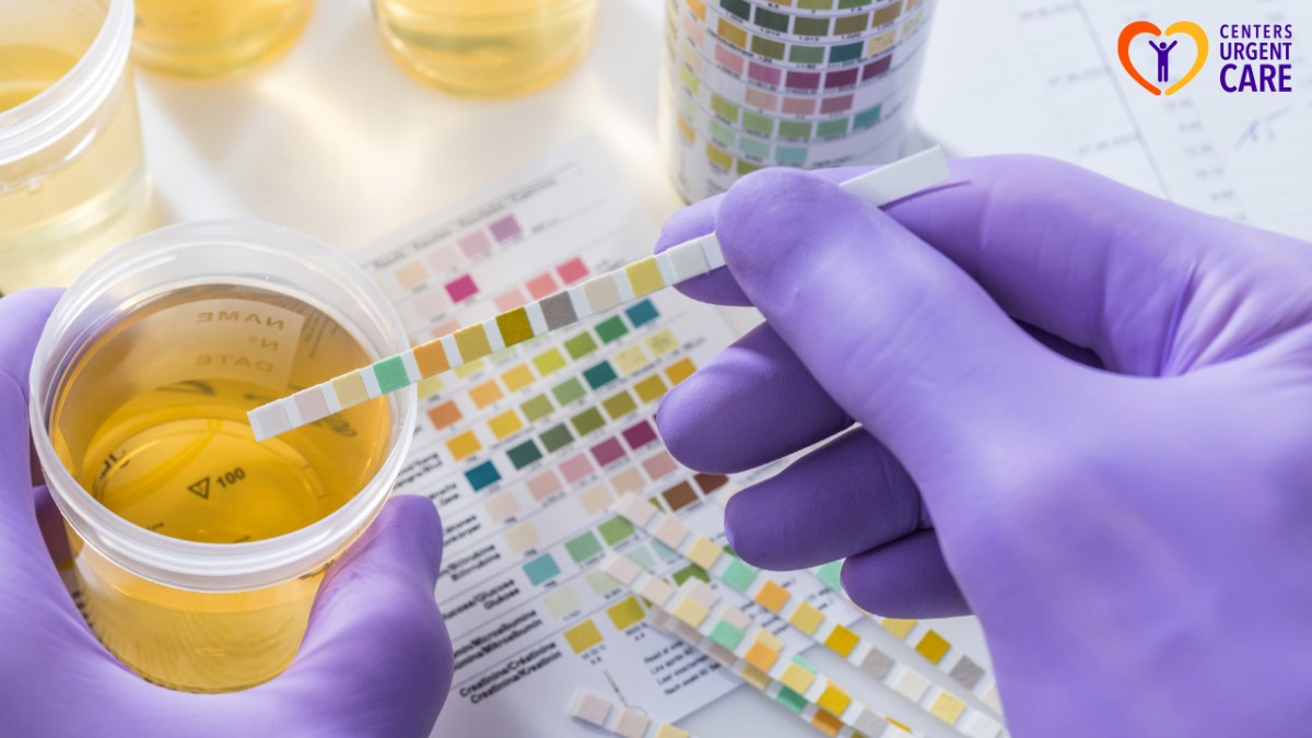 How to Read Microalbumin Urine Results to Understand Your Kidney Health ...