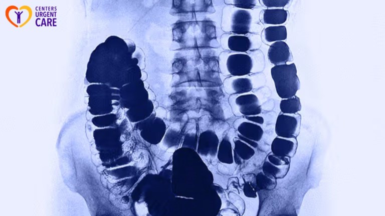 Contrast X-Rays for GI Imaging – How They Spot the Problem - Centers ...