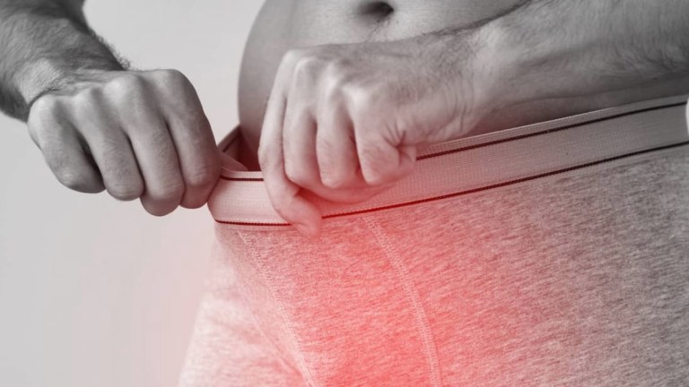 Lymphogranuloma Venereum: Causes, Symptoms & Insights - Centers Urgent Care