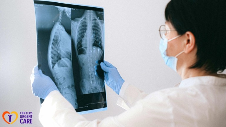 Must-Know Pediatric X-Ray Safety Protocols for Parents - Centers Urgent ...