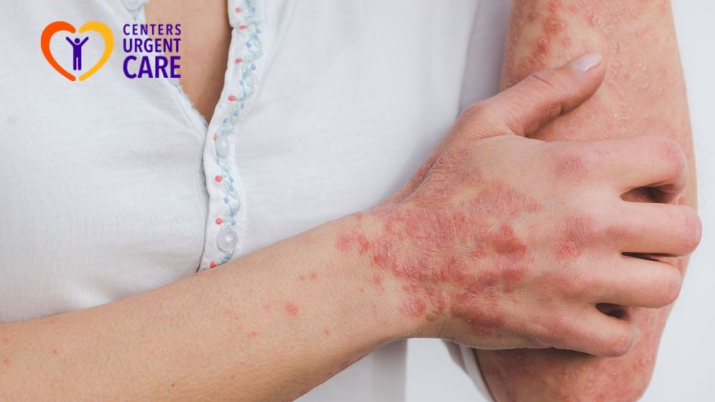 Walk-In Urgent Care Near Me | Centers Urgent Care in New York